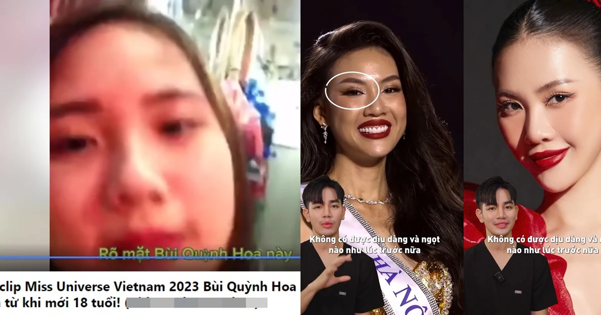 Rộ clip Bùi Quỳnh Hoa ăn chơi trác táng, thổi bóng, bị chuyên gia thẩm mỹ vạch mặt thực hư ra ...