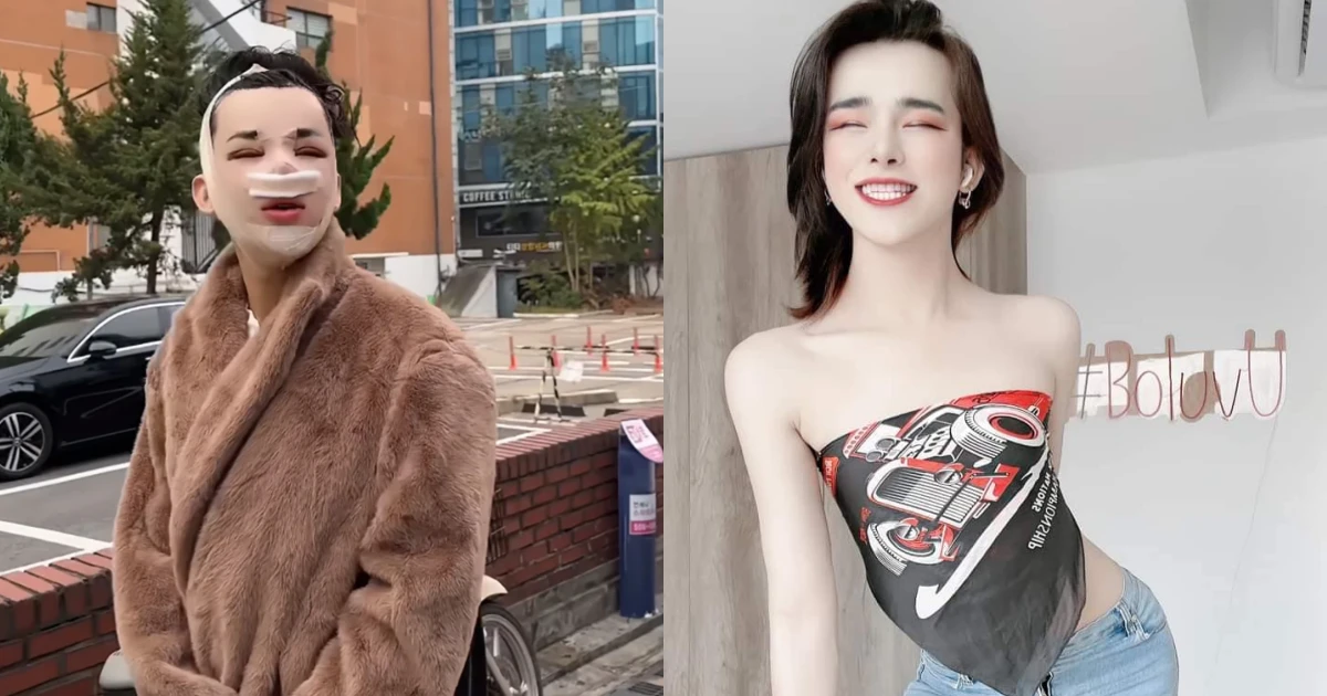 Trần Đức Bo:Từng tuyên bố lấy vợ, nay chi gần trăm triệu nâng ngực, nhan sắc dao kéo gây hoang ...