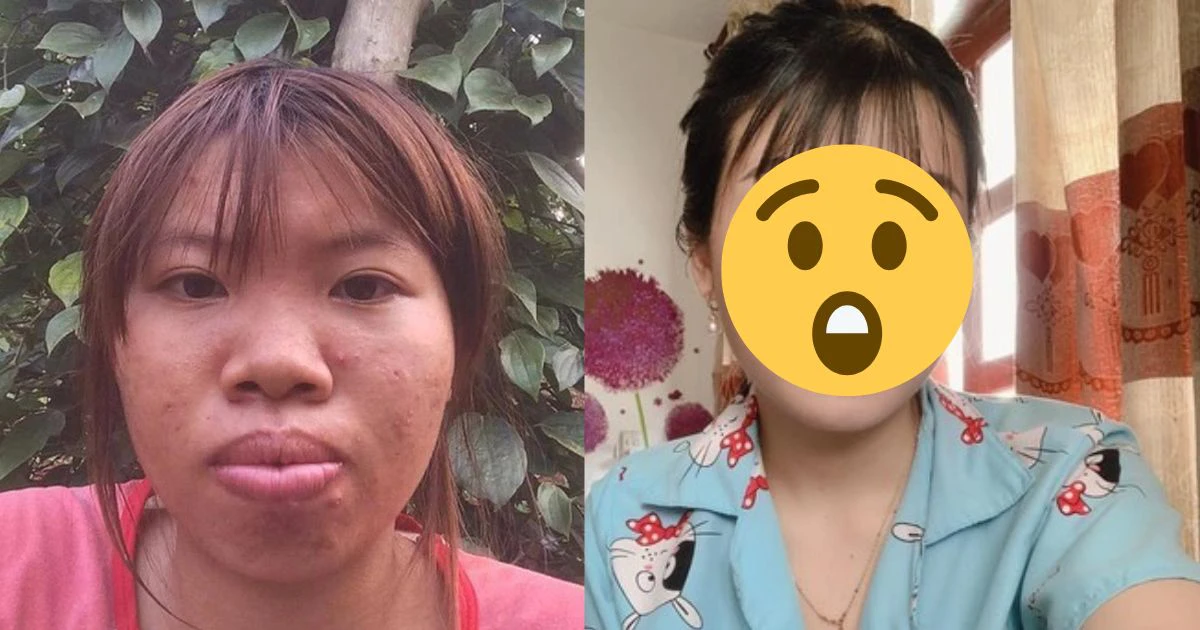 Phượng 'Thị Nở' sau 7 năm trùng tu, dung nhan siêu nét khiến nhiều anh hối hận | Người nổi tiếng ...