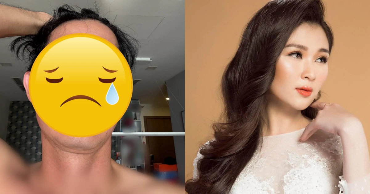 Huy Khánh mắc "bệnh lạ", mặt biến dạng sốc hậu ly dị, vợ cũ ngó lơ? | Showbiz Việt | Sao Việt ...