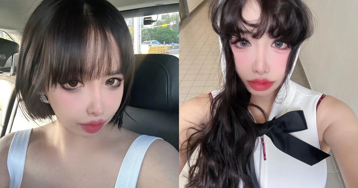 Park Bom (2NE1) shows signs of instability, face deformed, fans are ...