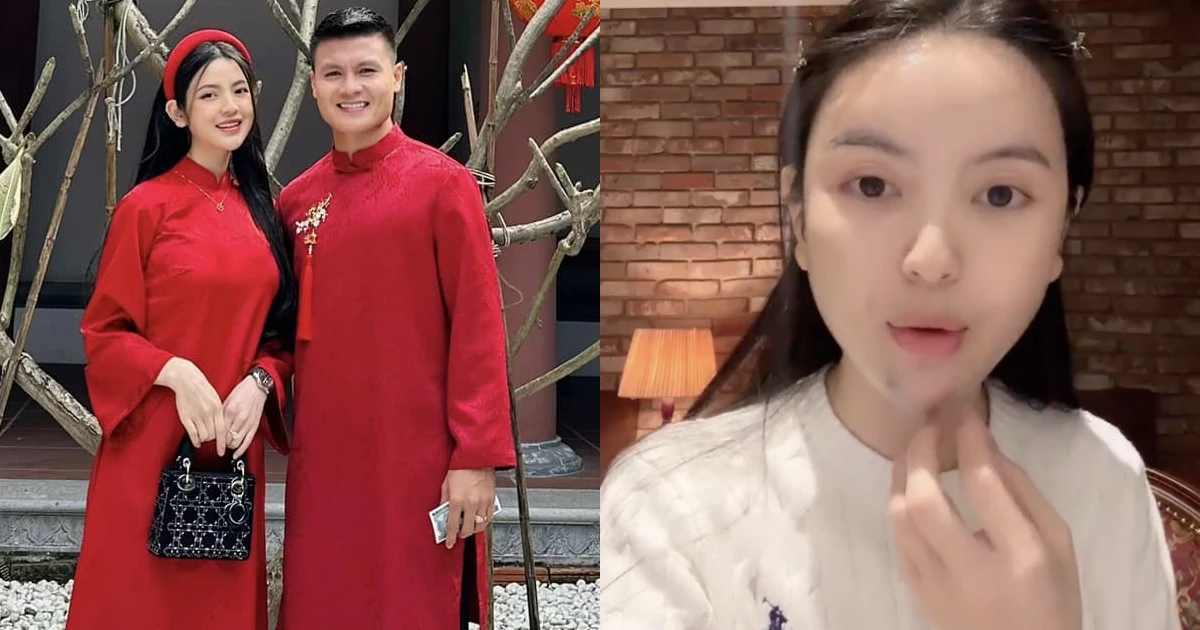 Vợ Quang Hải để lộ chiếc cằm sưng, kể trải nghiệm kinh hoàng liên quan "dao kéo" | Hot KOLs ...